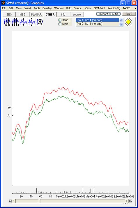 Dcm For Steady State Responses Spm Documentation