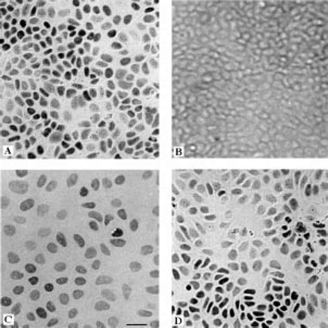 Microphotographs Of Mcf 7 Cells A Shows Control Cells At 8 Days Of