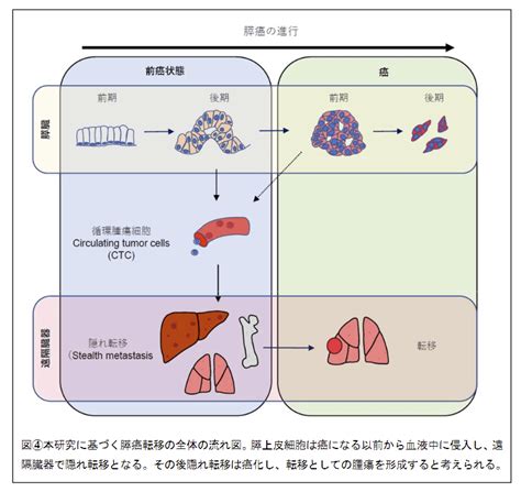 膵臓がんの転移は、”前がん状態”ですでに起きている 残る桜も 散る桜ー膵臓がん完治の記録