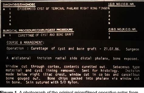 Figure 1 From Intraosseous Terminal Phalanx Epidermoid Inclusion Cyst