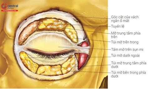 Đặc điểm Giải Phẫu Mi Mắt Và Những ứng Dụng Trong Phẫu Thuật Mắt