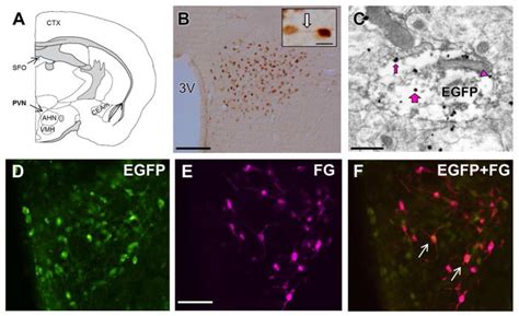 Slow Pressor Angiotensin Ii Hypertension And Concomitant Dendritic Nmda