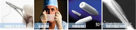 建议收藏 生物医用高分子材料的分类及应用 知乎