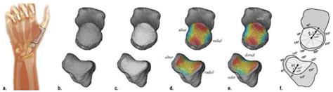 Figure 1 From The Articular Morphology Of The First Carpometacarpal Joint Does Not Differ