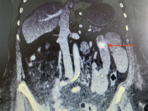 Figure Computed Tomography Of The Abdomen Statpearls Ncbi