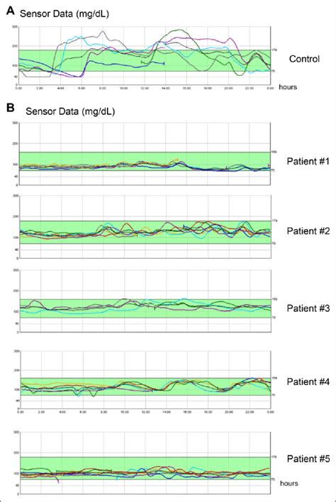 Glucose Profiles Achieved By Retrospective Continuous Glucose
