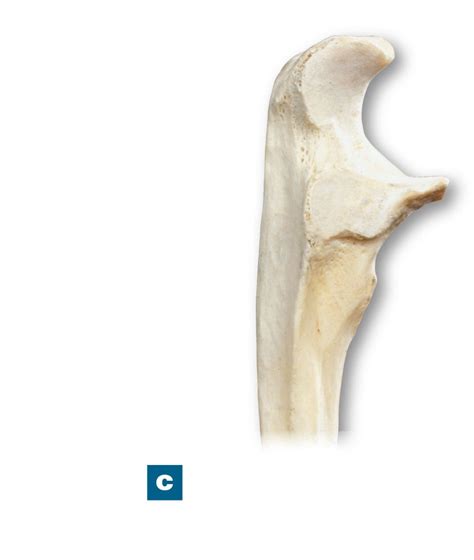 Trochlear Notch Of Ulna Lateral View Diagram Quizlet