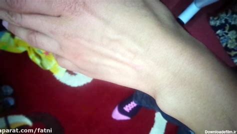 عکس فیک رگ زدن دختر