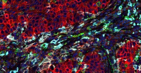 Plex Your Way With Signalstar™ Ihc Cell Signaling Technology Cst Posted On The Topic Linkedin