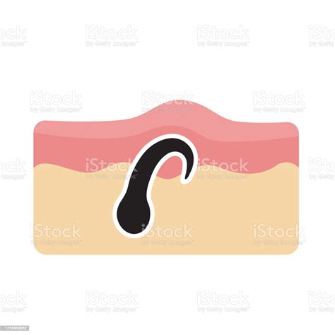 Hair Icon Hair On Human Skin Hair Care Concept Solve The Problem Of