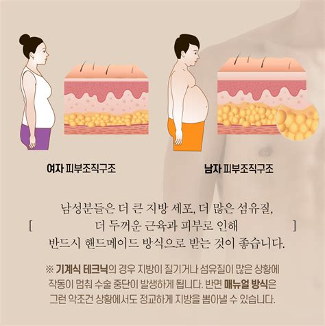 남자 지방흡입 강남더슬림의원