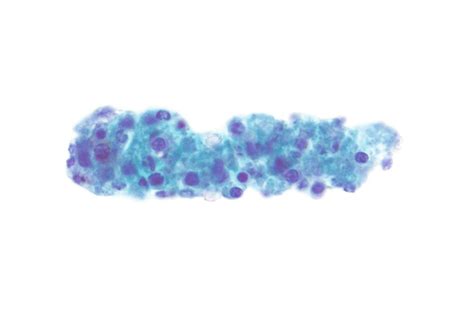 Body Fluids And Clinical Microscopy Basicmedical Key