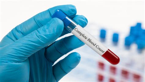 What Is A CBC Test Medibuddy