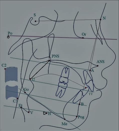 Cephalometric Evaluation Of Posterior Airway Space In Chinese And