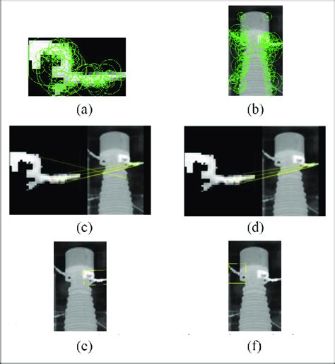 Region Positioning Based On Surf Algorithm A Surf Feature Points In