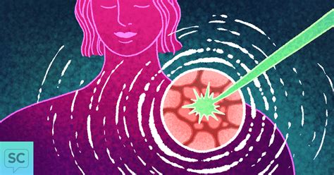 Radiation Therapy For Skin Cancer How And Why It Works