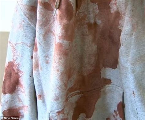 Plumber Is Stabbed In The Stomach And Head After A Vicious Brawl Erupts
