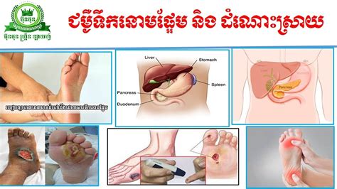 ជំងឺទឹកនោមផ្អែម Youtube