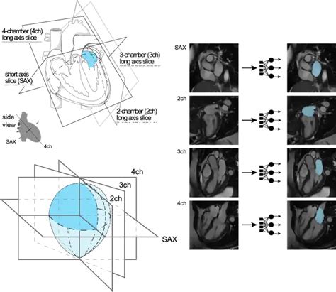 Deep Learning Of Left Atrial Structure And Functio Ainave