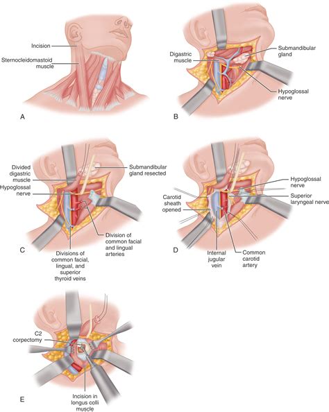 Anatomic Approaches To The Spine Clinical Tree