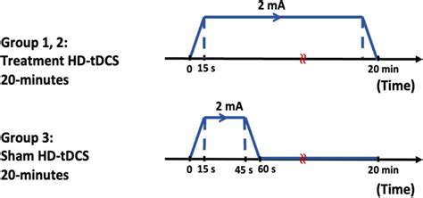 Anodal HD TDCS On The Dominant Anterior Temporal Lobe And Dorsolateral Prefrontal Cortex