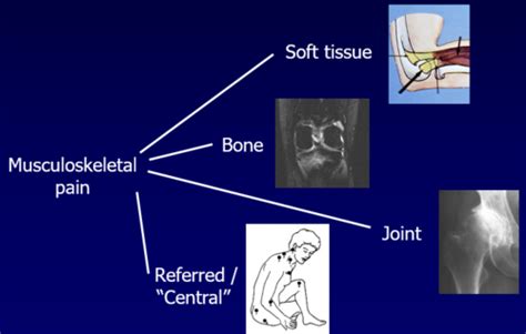 Soft Tissue Disorders Flashcards Quizlet