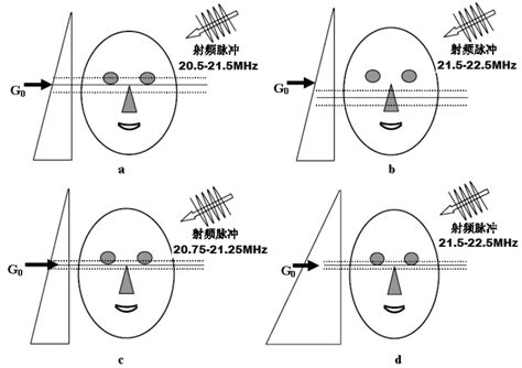 磁共振成像（mri）原理 知乎