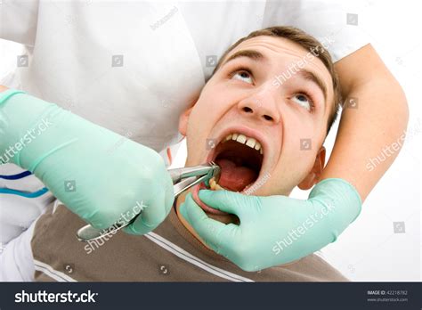 Patient At The Dentist Tooth Extraction Stock Photo Shutterstock
