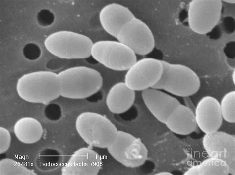 Streptococcus Lactis Microscopic