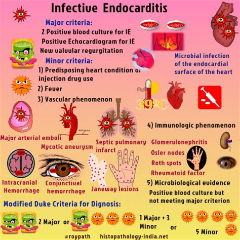 Infective Endocarditis Signs And Symptoms