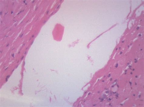 Human Artery And Vein Prepared Microscope Slide