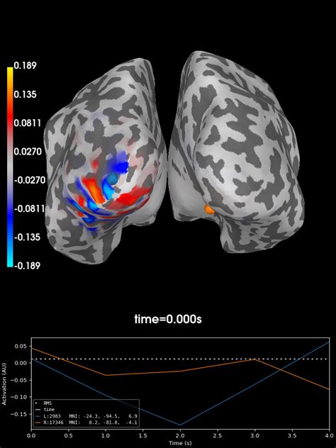 Visualize Source Leakage Among Labels Using A Circular Graph MNE 1 11 0 Dev60 G523f221bb