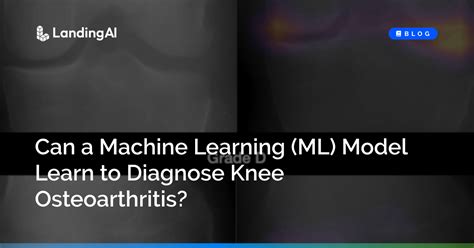 Can A Machine Learning Ml Model Learn To Diagnose Knee Osteoarthritis Landingai