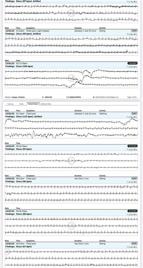 Help Reading Zio Patch Results Rpvcs