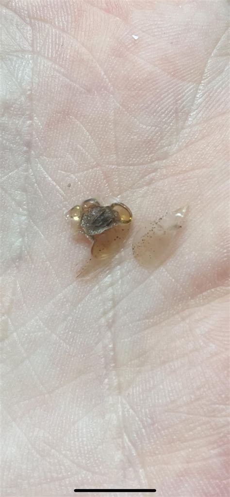 Hardened Sap On Monstera Rplantclinic