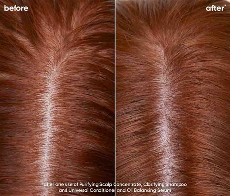 Biolage Scalp Sync Clarifying Shampoo Hair Cosmopolitan