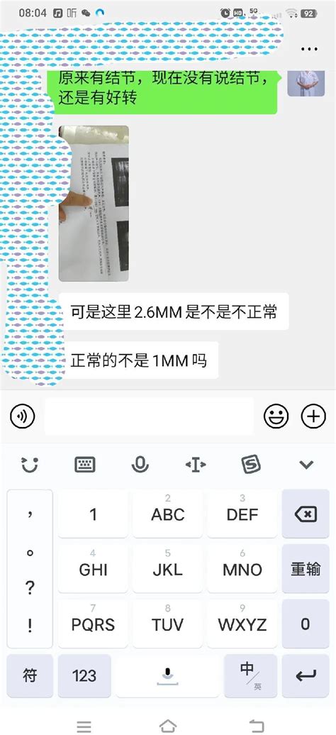 乳腺导管大小与健康关系