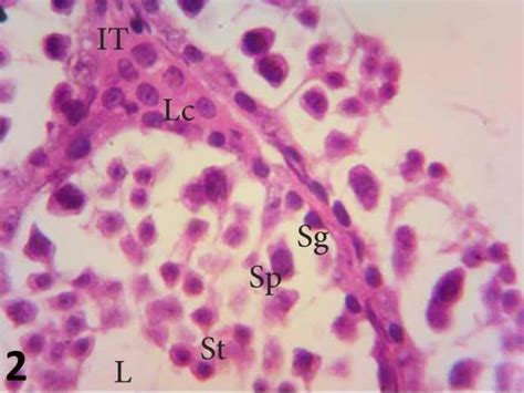 Section Of Testis Of Control Mice 1 5 Month Hande X400 Showing Download Scientific Diagram