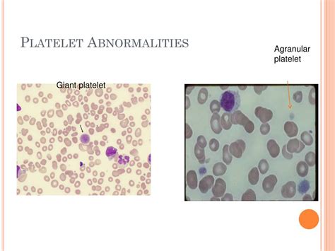 Ppt Mlab 1227 Coagulation Keri Brophy Martinez Powerpoint