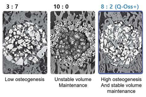 Synthetic Bone Material At Adelina Thompson Blog