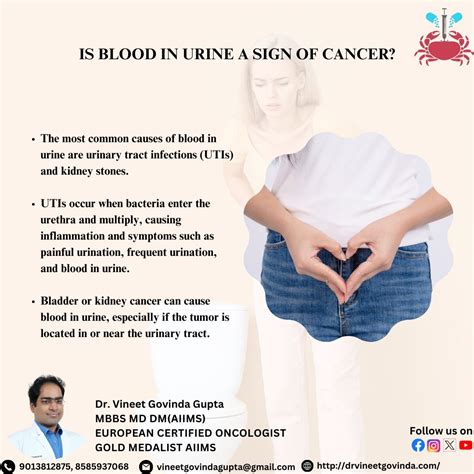 The Most Common Causes Dr Vineet Govinda Gupta Oncology