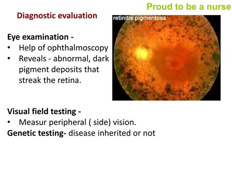 Retinitis Pptx