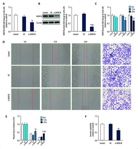 Mon1b Interference Inhibited Cell Proliferation Migration And
