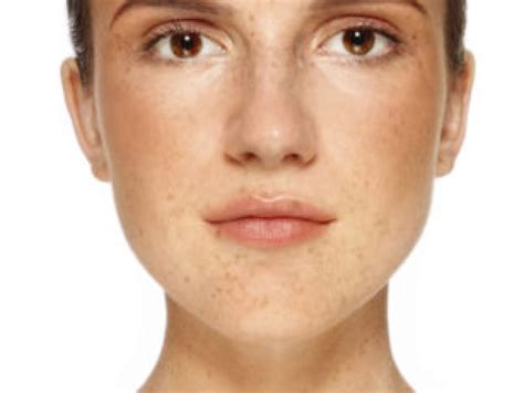 Fading Dark Spots On Face