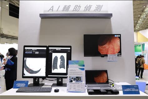 Ai輔助篩檢 大腸癌、肺癌及早追擊
