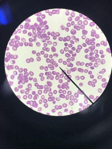 Parasitology Midterm Flashcards Quizlet