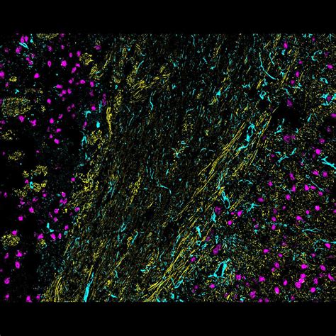 From Image To Results Enabling 3d Multiplexing Spatial Omics Workflows In Neuroscience