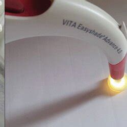 Shade Matching By Digital Spectrophotometer Download Scientific Diagram