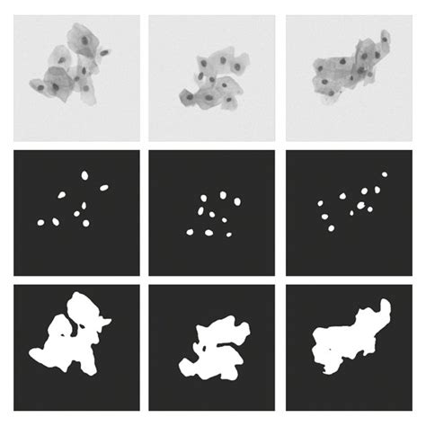 examples of pap smear images from the isbi 2014 challenge dataset