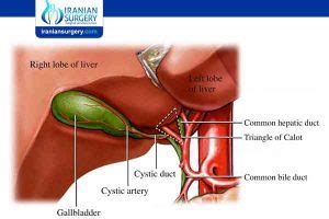 Cholecystectomy Complications Symptoms Of A Bile Leak After Gallbladder